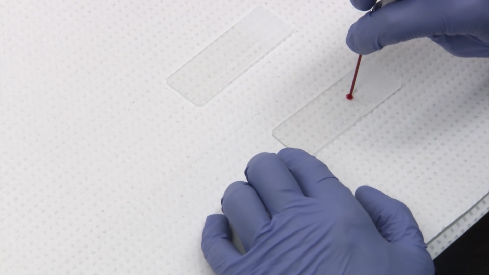 Sample Collecting – Vet Diagnosis