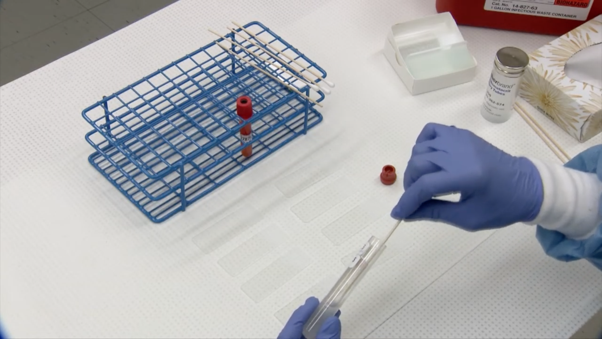 Sample Collecting – Vet Diagnosis